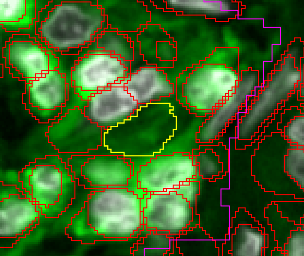 Session 6 - Classifying Cells (pt1) — From Samples to Knowledge 2025