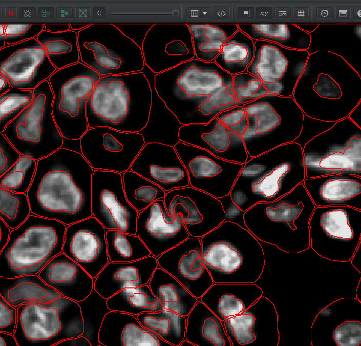 Session 4 - Cell Detection — From Samples to Knowledge 2025